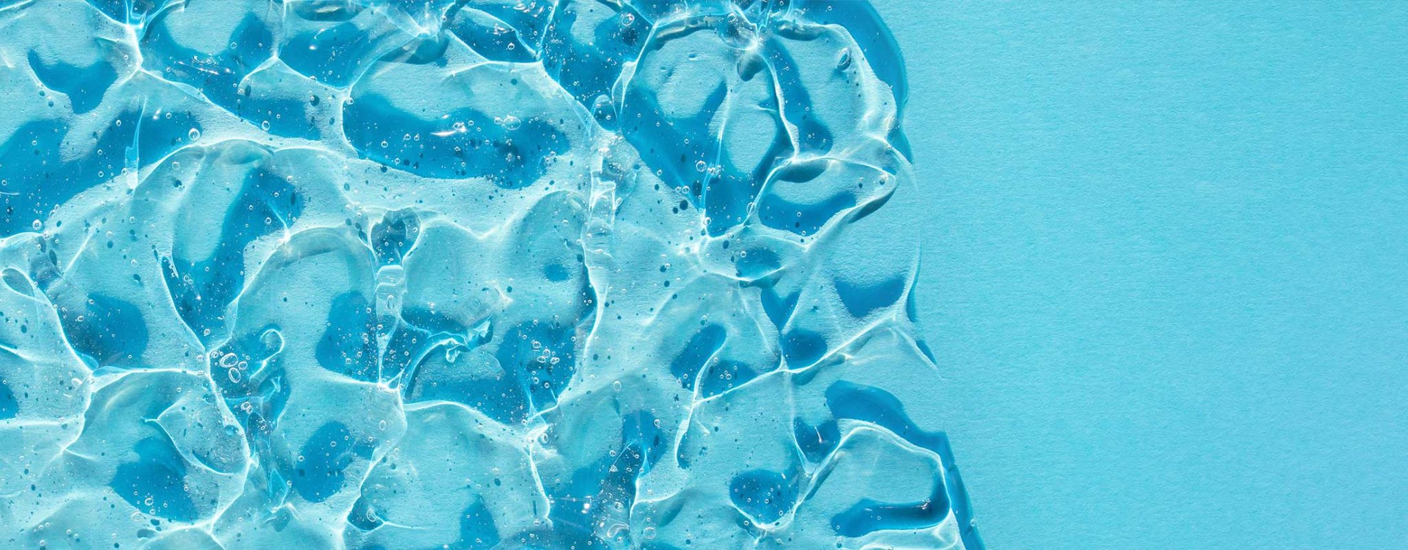 Radiesse Que Es: Caso Real Tratado En Clinica EM, 5 Datos