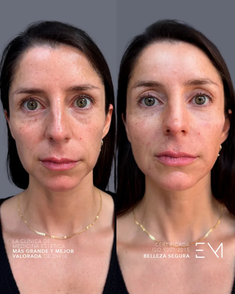 Be Your Valentine Clínica EM: Cuídate Con Beneficios Exclusivos